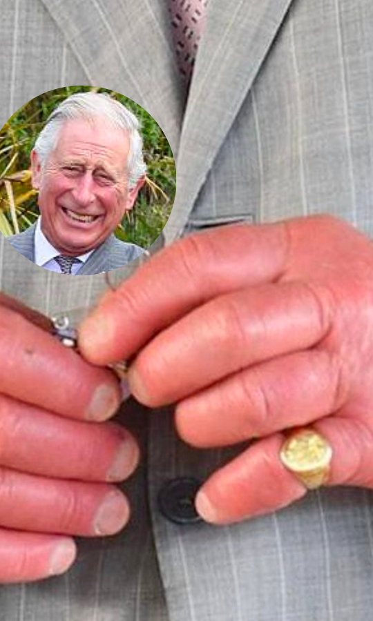 The Truth Behind King Charle's Large Fingers
