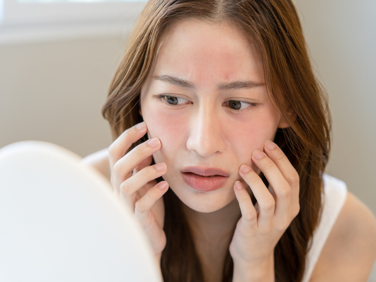 Still getting acne? These 7 simple fixes might be the real solution