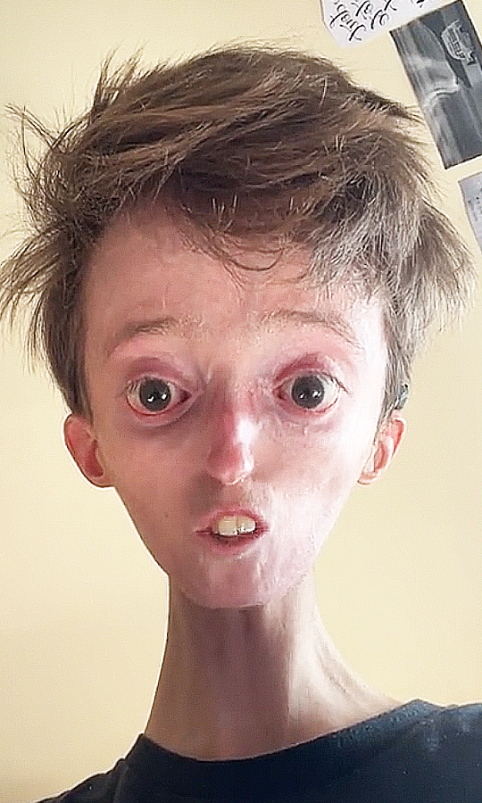 I get trolled for the way I look 😢