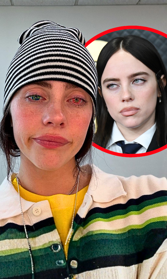 Billie’s “incredibly confusing” diagnosis 😮