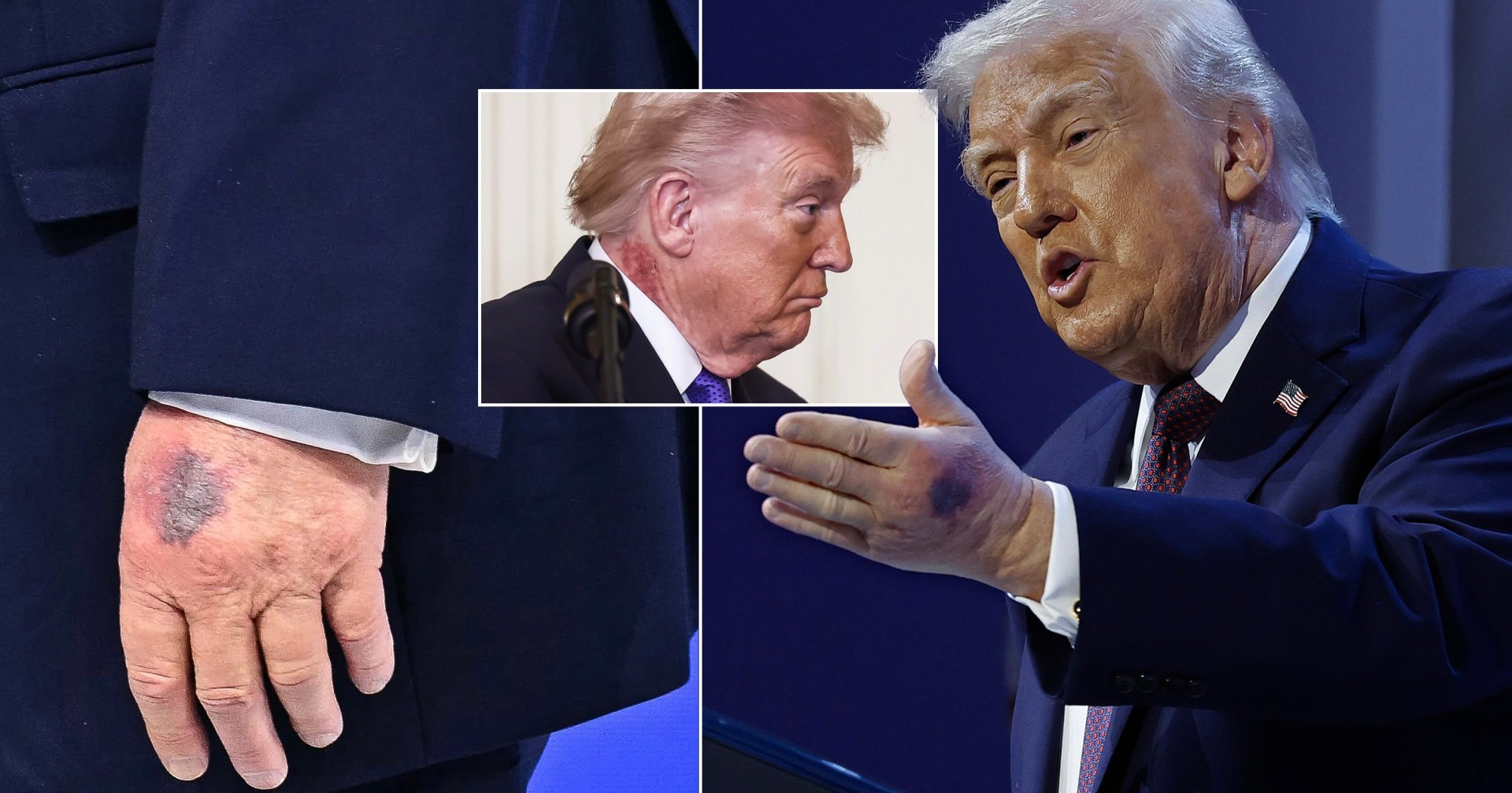 Donald Trump in hospital for third check-up in 13 months as health ...
