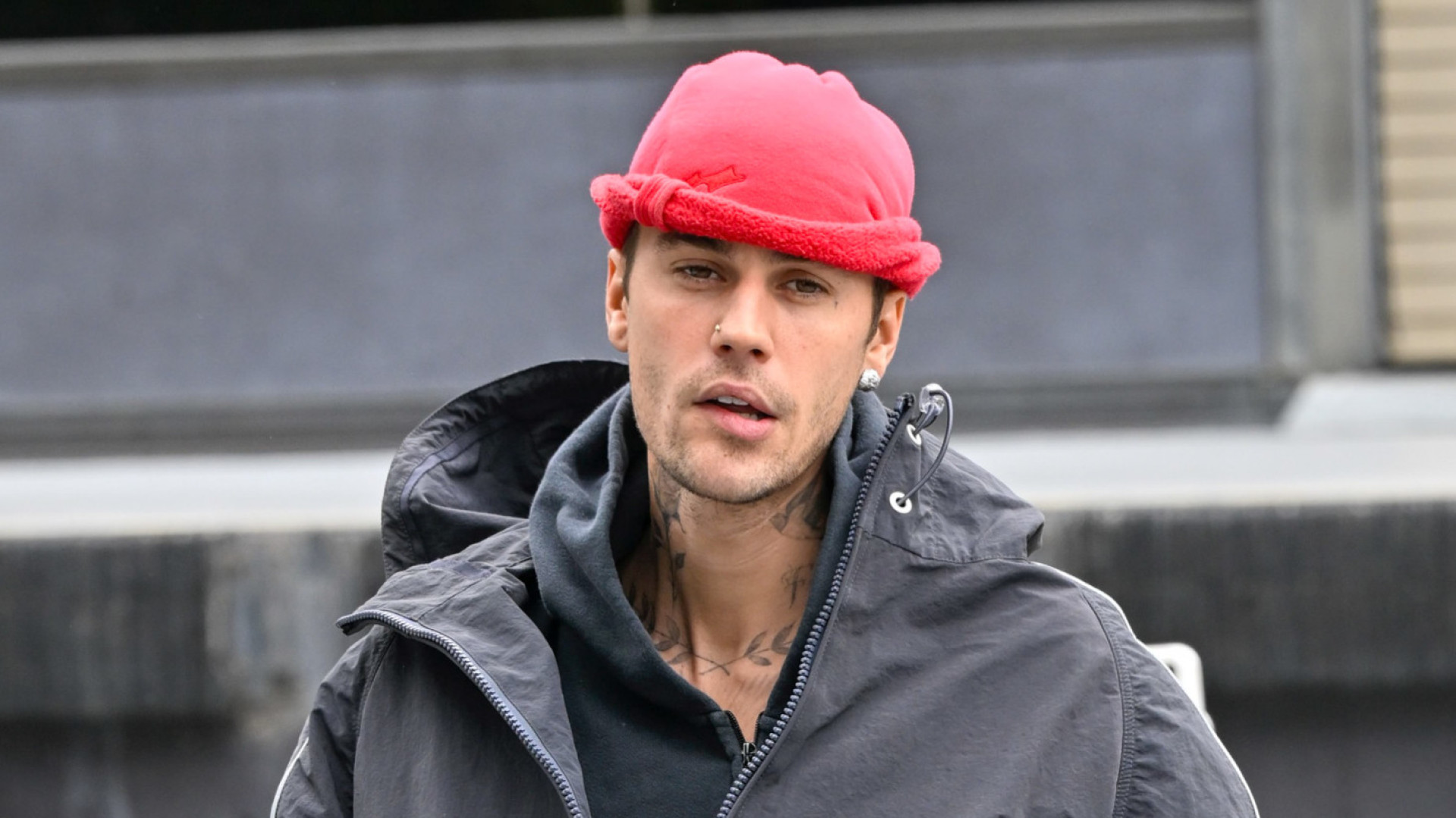 Celebrities who have struggled with face paralysis