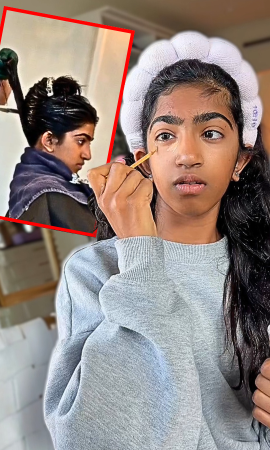 TikTok mom lets 14-yr-old get hair botox 🚨
