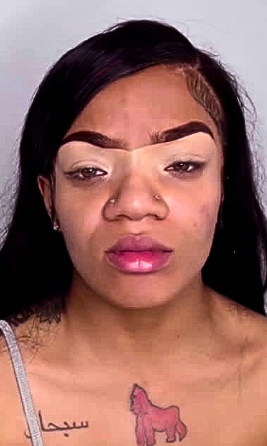 GloRilla addresses facial surgery