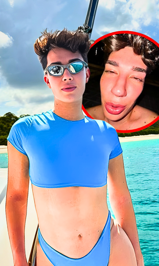 James reveals surgery