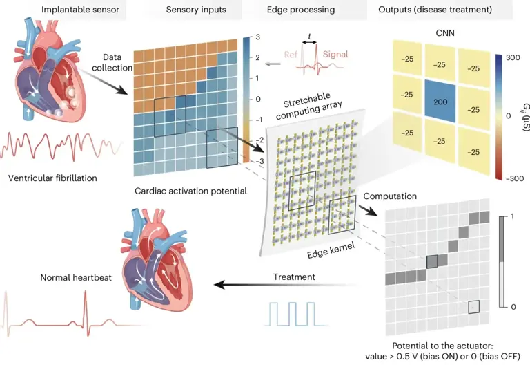 Stretchable AI skin patch analyzes heart data on the body in milliseconds