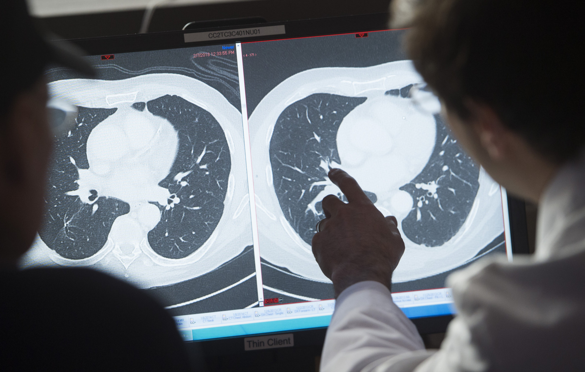 HPV: What you need to know and how to protect yourself