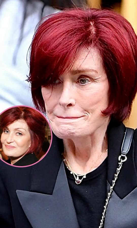 Sharon Osbourne's transformation 🚨