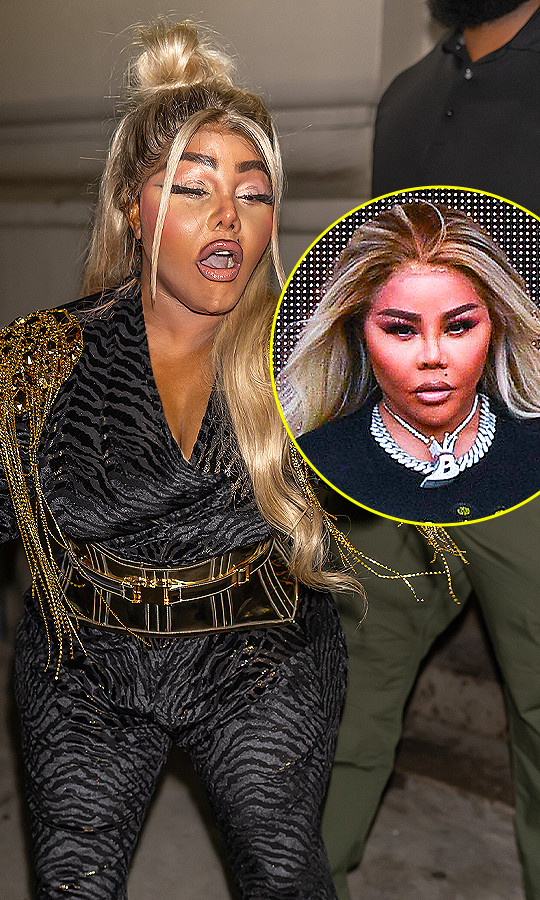 Lil Kim's 💔 reason for getting surgery