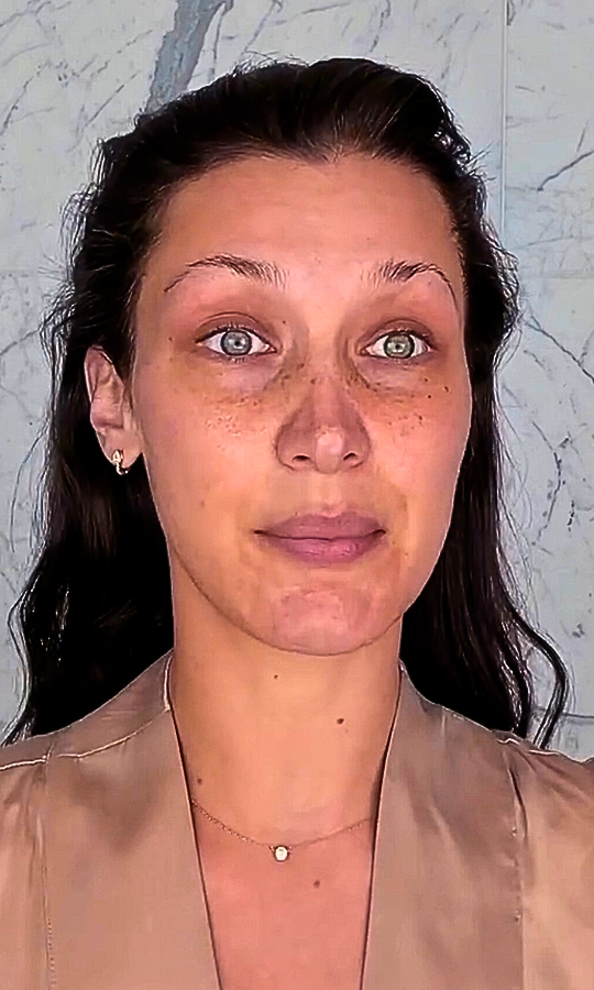 Bella reveals her surgery regrets