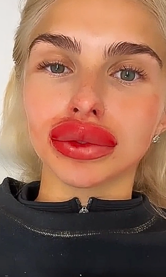 This TikTok trend can damage lips