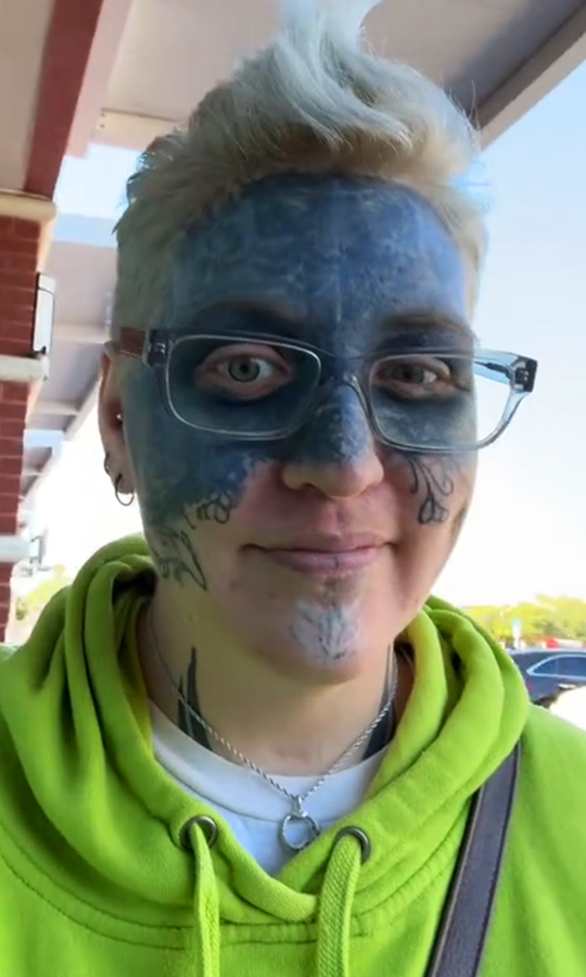 Wild face tattoo laser removals