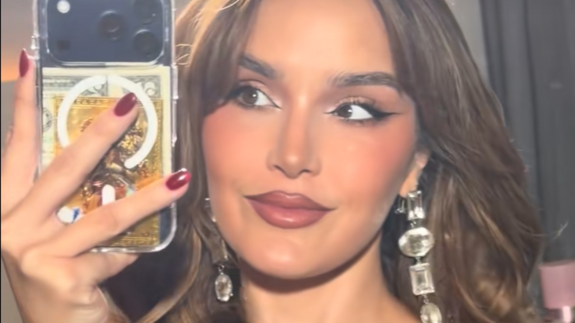 Miss Venezuela Global 2025, que resultó herida en la cara en Cannes ...