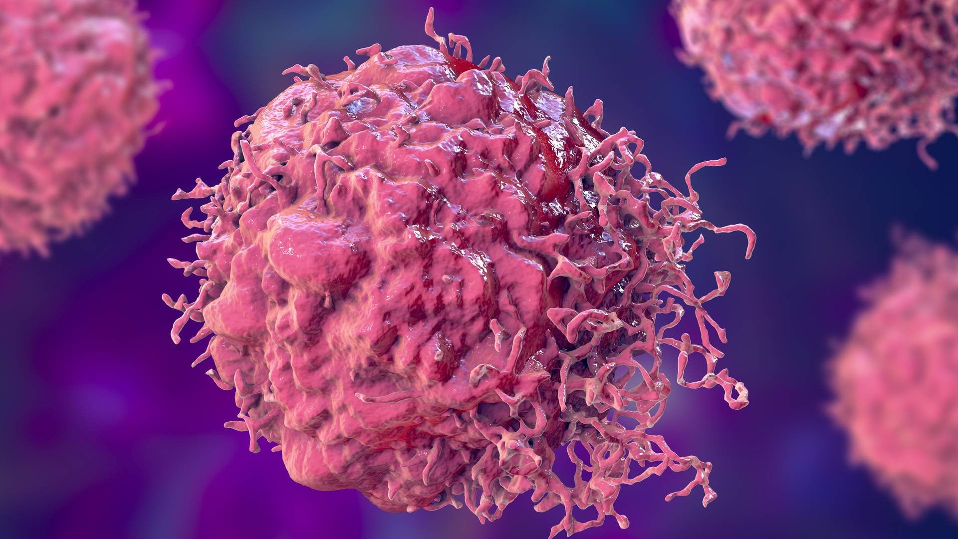 Chinese scientists build handheld cancer detector with 94.9% accuracy ...