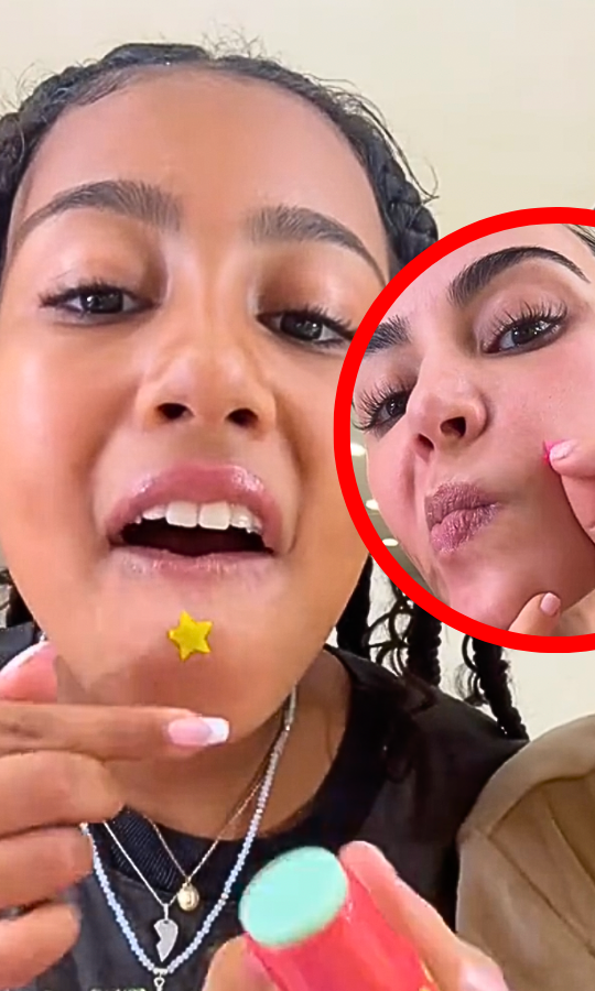 North and Kim wear pimple patches