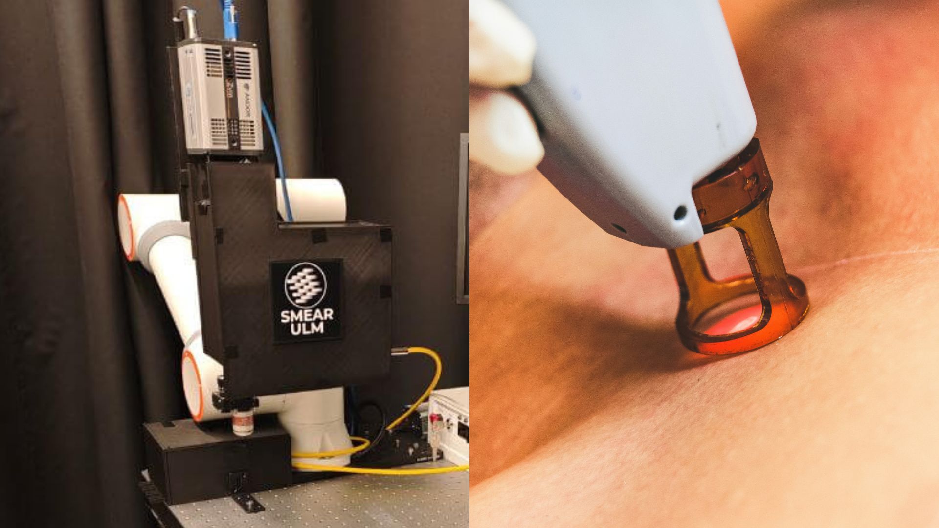 New nanoparticle-based 'intelligent tattoo' uses heat signals to detect ...