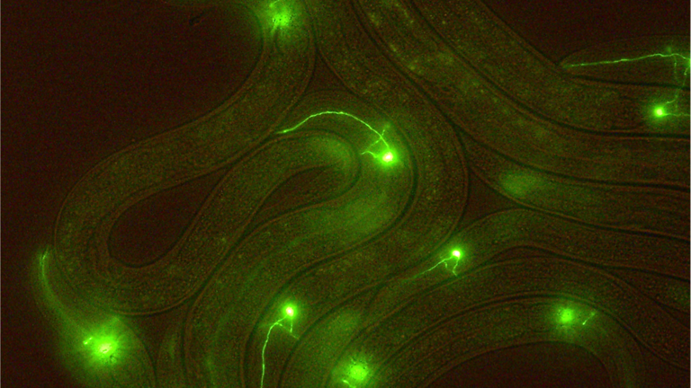 New microscopy method speeds 3D brain scans while using fewer measurements