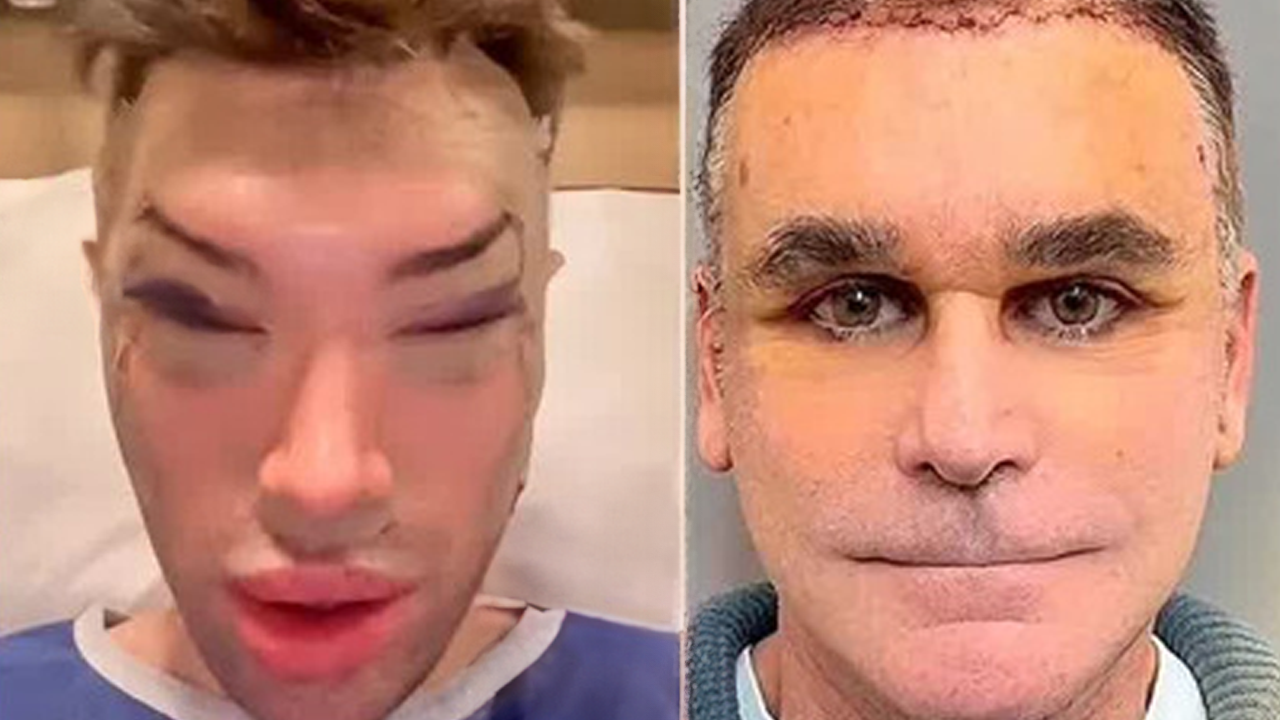 Plastic surgeon reacts to extreme plastic surgery TikToks