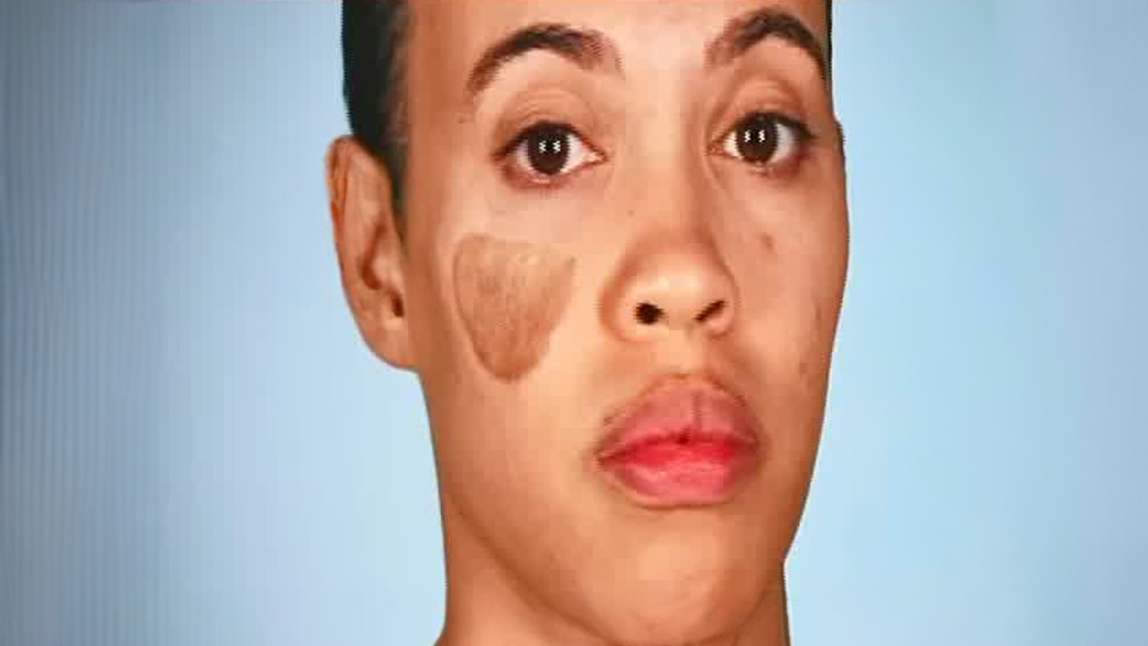 Doctor reacts to unusual hair growth condition