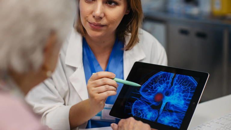 New drug asundexian reduces secondary stroke risk by 26% without ...