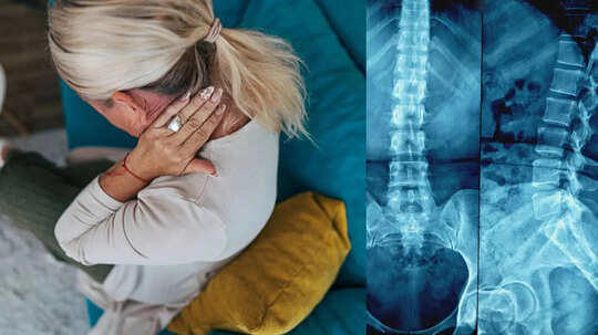 Ankylosing spondylitis can silently freeze your spine - here’s how to ...