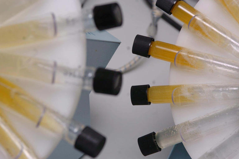 Groundbreaking urine test could detect lung cancer before symptoms
