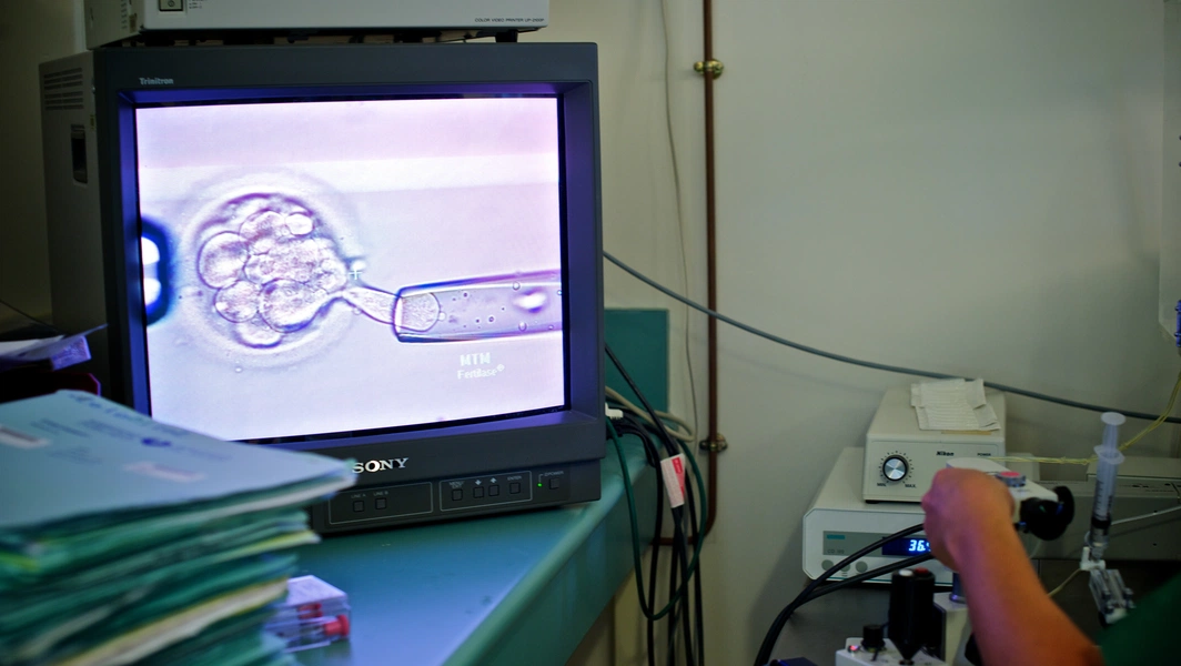 Doctors flag rising heterotopic pregnancy risk in IVF patients