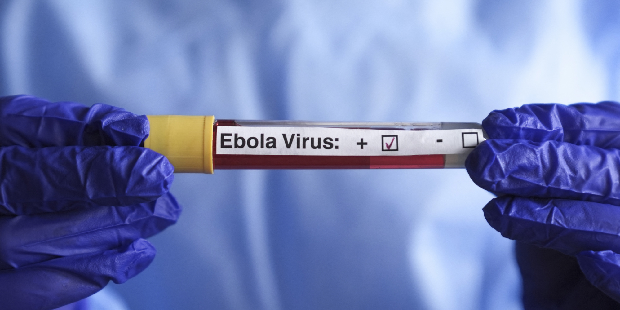 Ouganda : deux nouveaux cas confirmés d'infection au virus Ebola