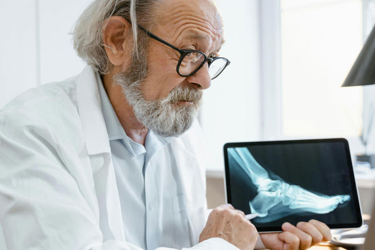 Why do women start losing bone strength earlier than they think ...