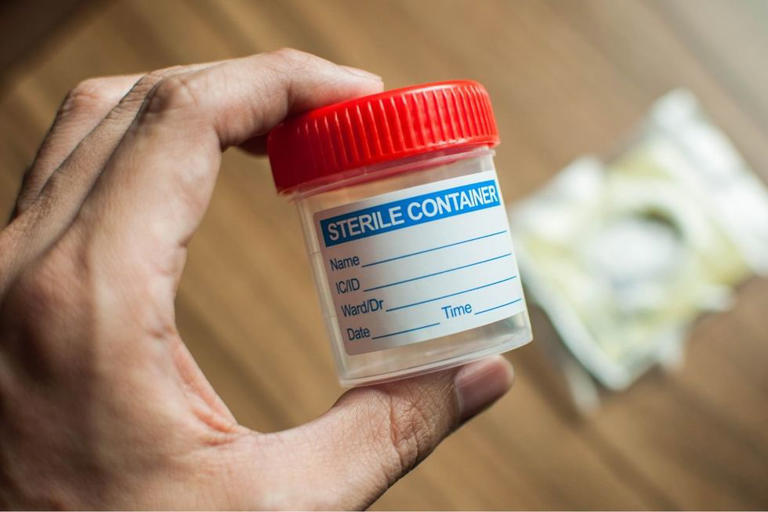 'Zombie' cell urine test could catch lung cancer months before symptoms ...