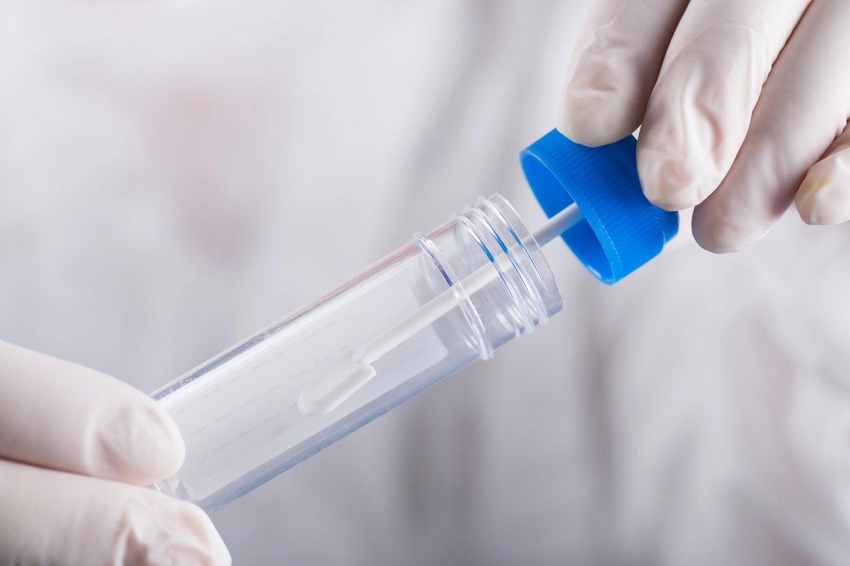 Teste imunoquímica fecal: o que é, para que serve (e como é feito)