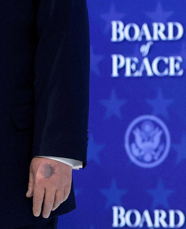 Trump, near 80, has third medical exam amid questions on health: 'maybe ...