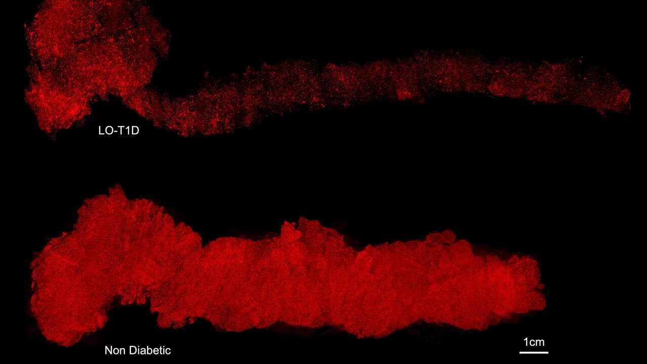 Whole organ 3D imaging reveals remaining insulin producing cells in ...