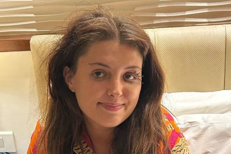 Student survives scooter crash but left with brain injury and memory ...