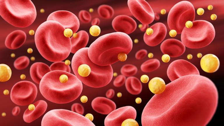 Revolutionary new treatment can lower bad cholesterol by up to 62% ...