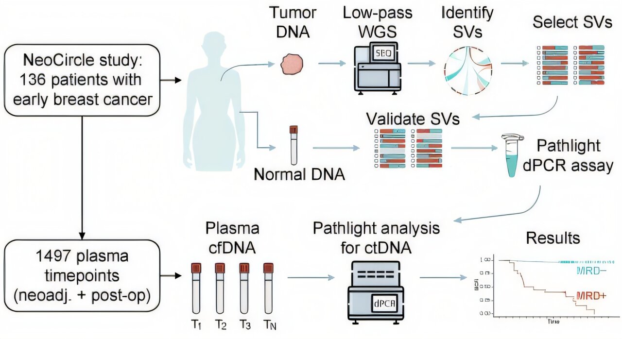 Blood test detects early signs of breast cancer recurrence