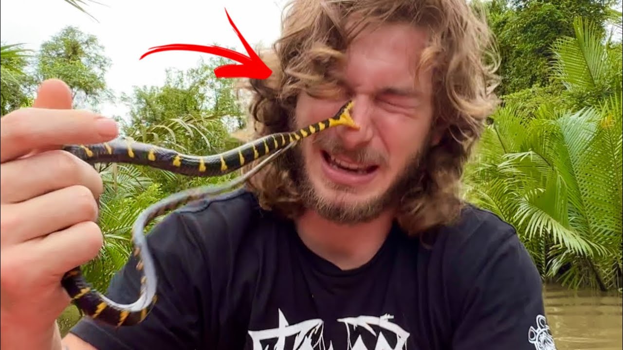 Venomous snake bite to the face