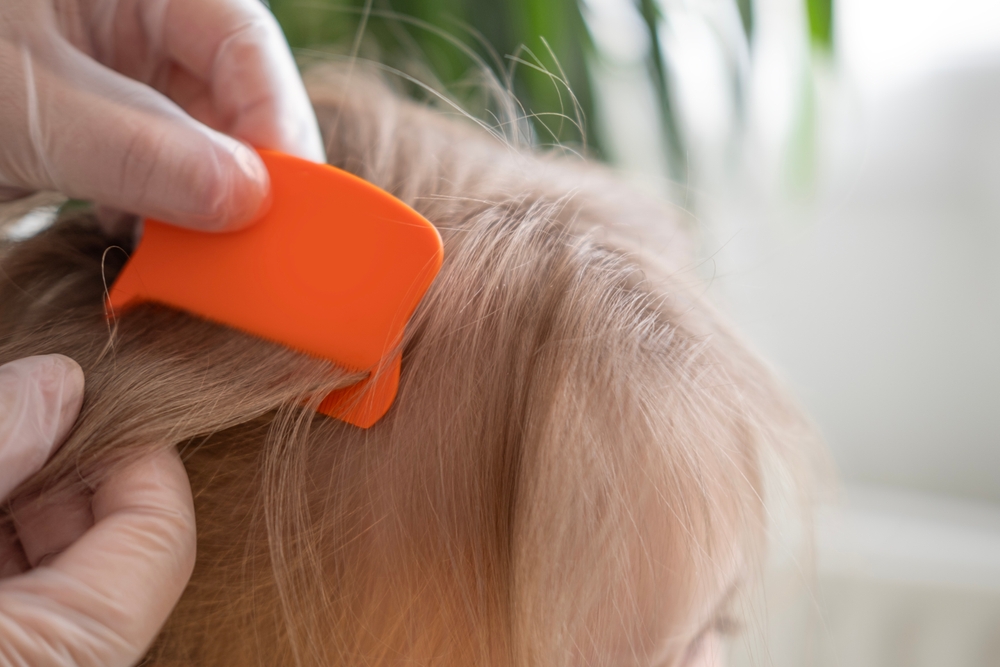Head lice in the family? Here’s how to get rid of them effectively