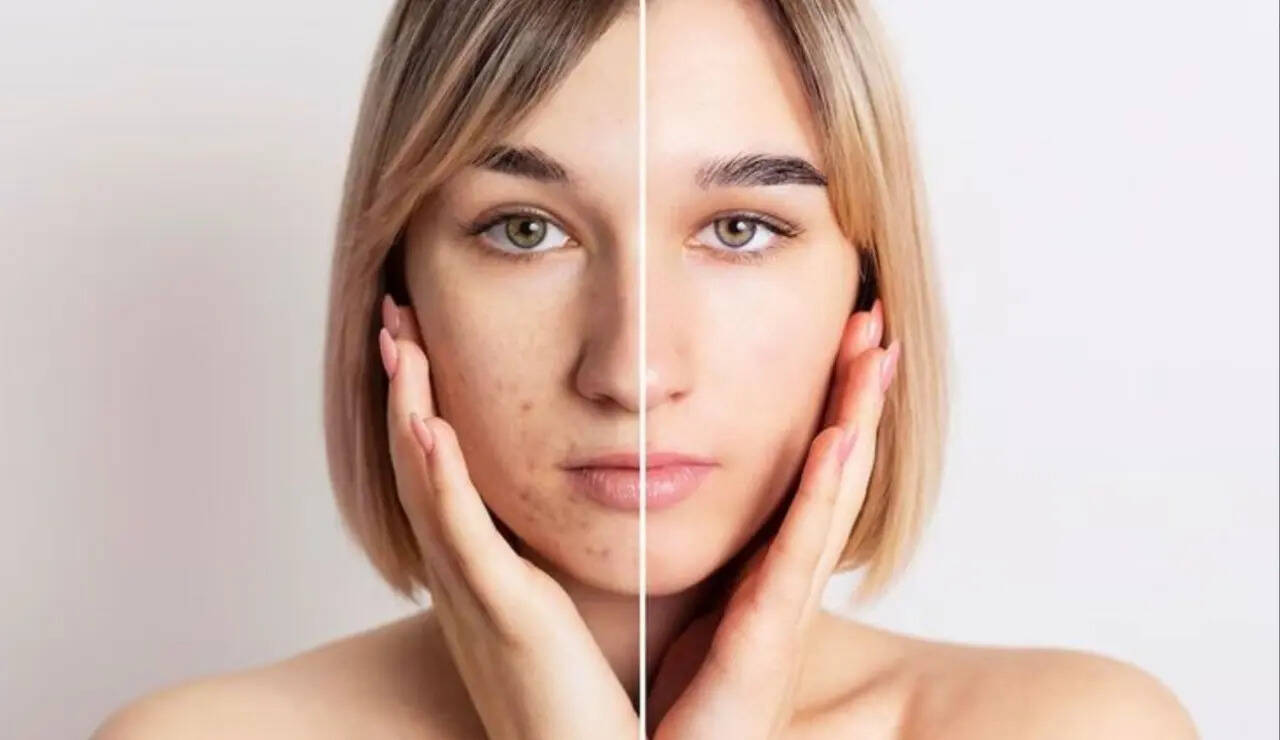 Skincare solutions for pigmentation and uneven skin tone: One step you ...