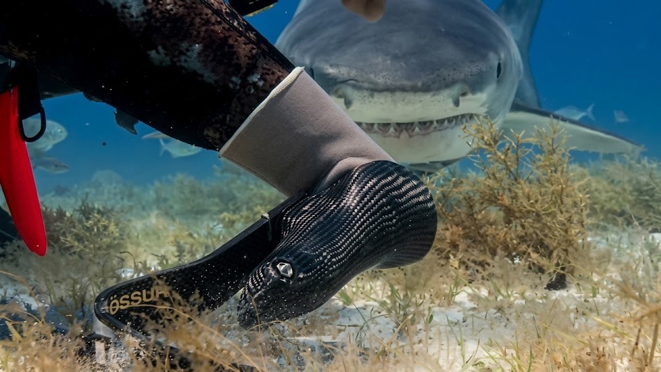 A tiger shark tore off his leg at 18 - then he went back to face her again