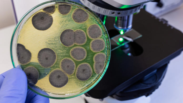 The gross things mold spores can do to your body