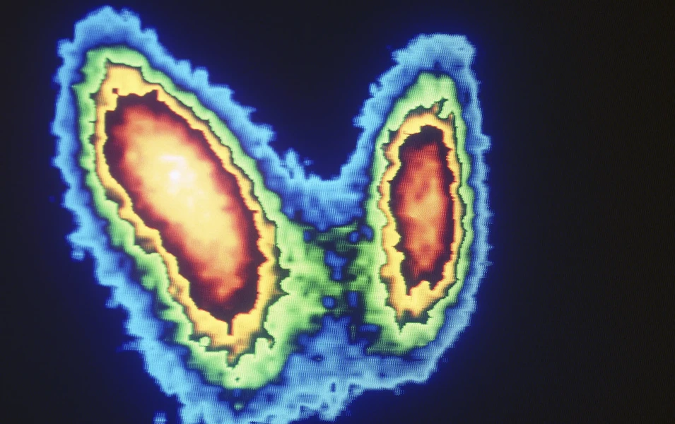 Experts warn rising thyroid disorders may silently impact fertility