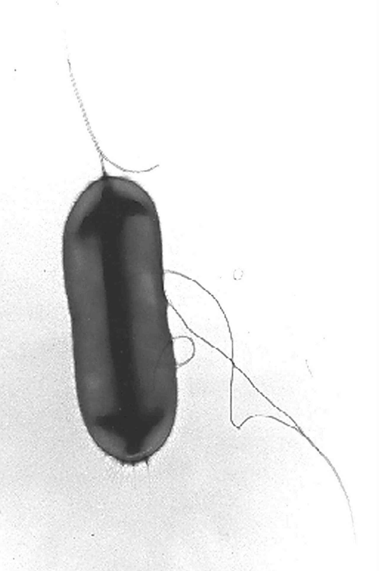 E coli alert tied to beef at Kebab Shop restaurants, including in Texas