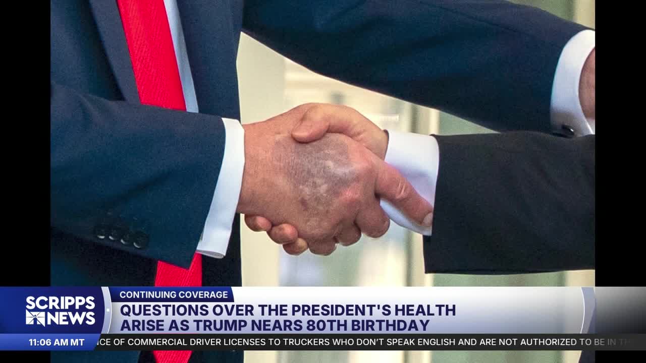 Trump says 'everything checked out perfectly' after undergoing physical ...