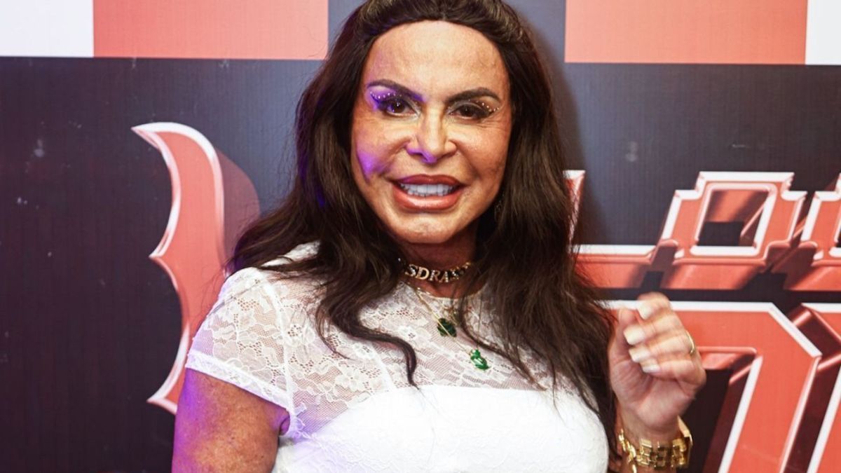 Gretchen fala sobre alopecia progressiva: "Mexe muito com minha autoestima"