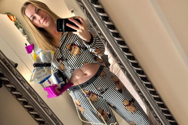Taunton woman with two rare conditions raises funds for 'life-changing ...