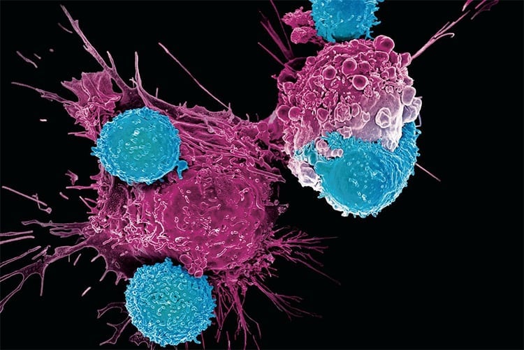 GIST's dual enzyme system starves, attacks cancer cells