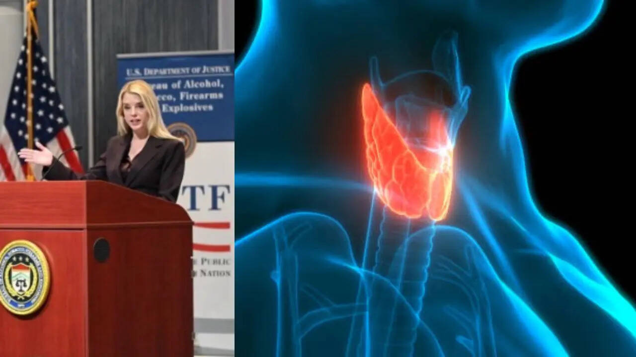 Pam Bondi thyroid cancer report sparks health alarm: Early symptoms ...