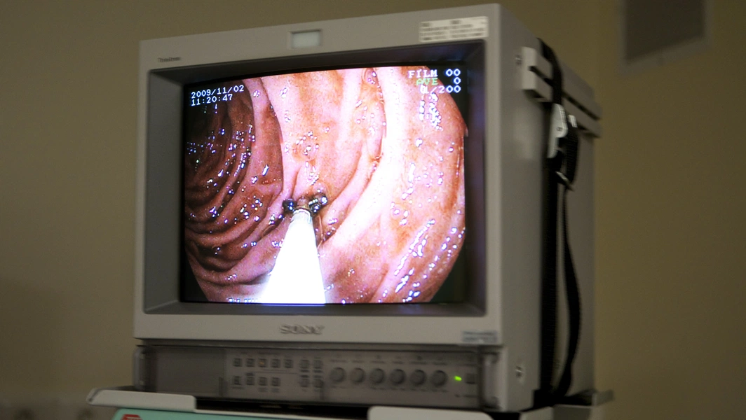 New research clarifies key differences between Crohn’s and colitis