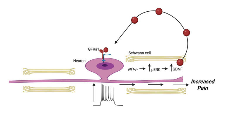 Schwann cells may trigger NF1 pain before tumors appear, mouse study ...